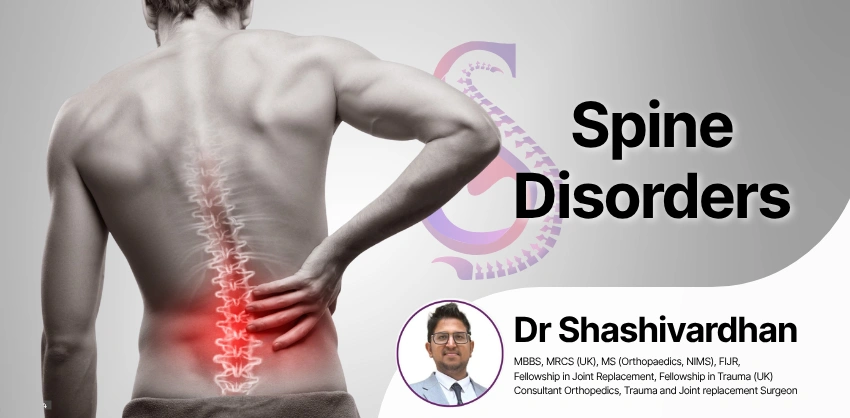 Spine & Sciatic Pain Treatment in Manikonda, Hyderabad | Dr ...
